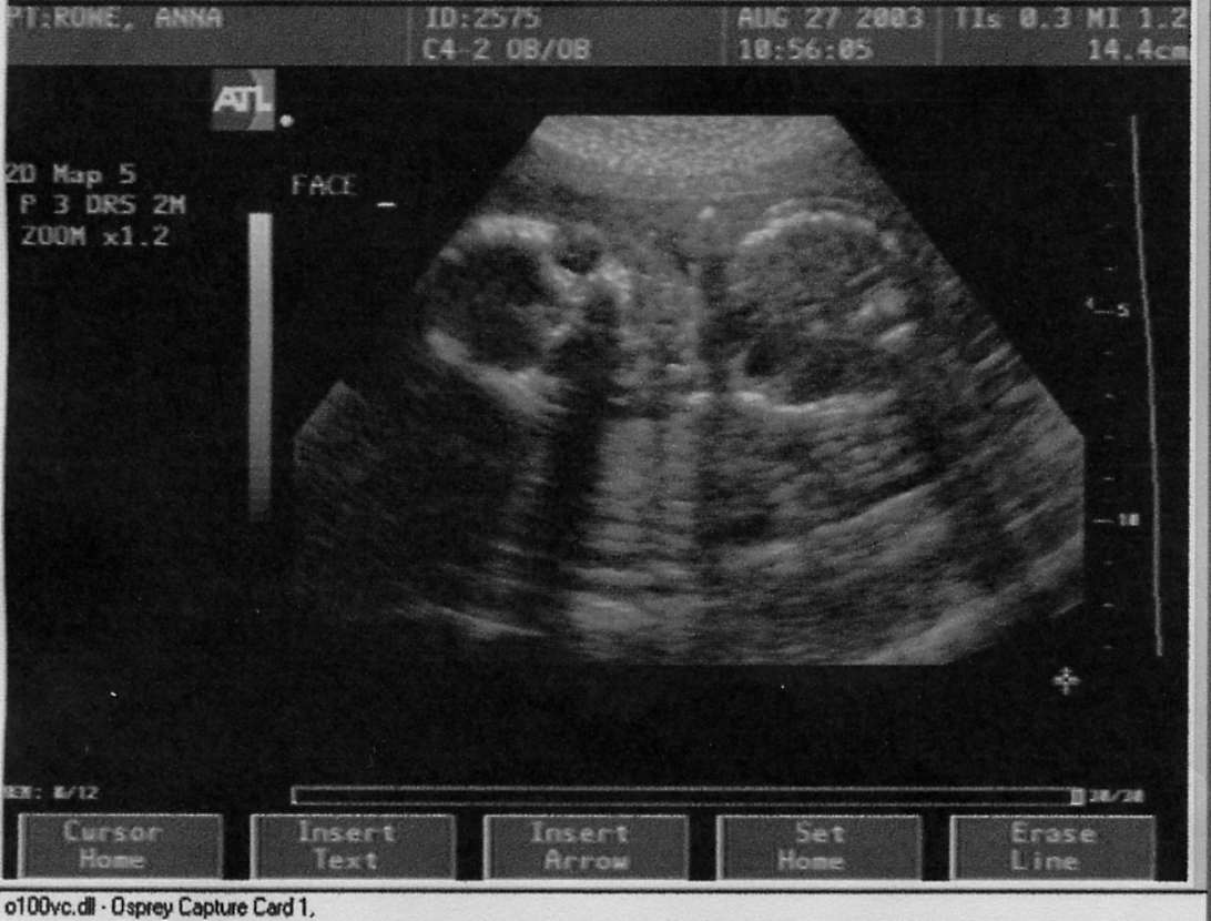 Will's 40 weeks before birth